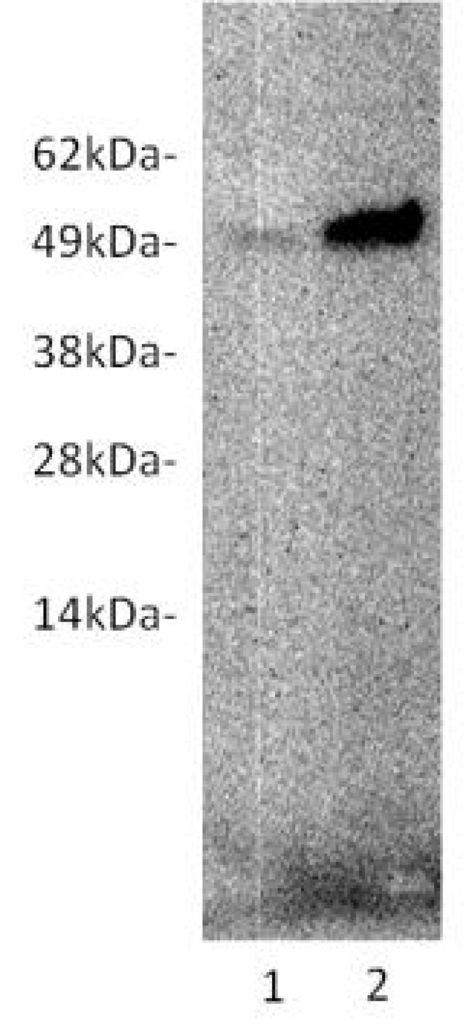 Human ANGPTL7 Monoclonal Antibody (ANG7-1G8) | Ampersand Biosciences