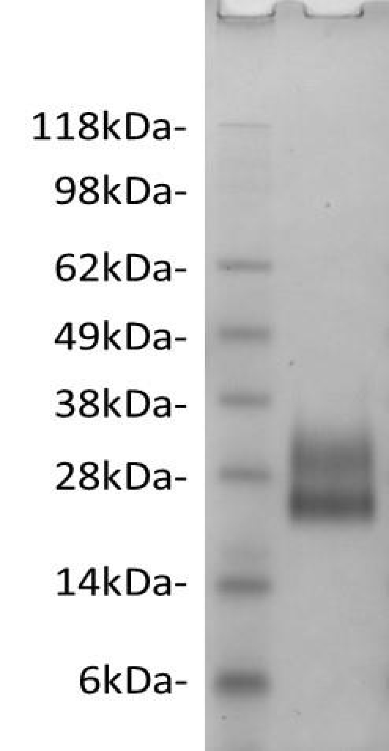 Recombinant Hamster IL-4 Protein (HEK293) | Ampersand Biosciences